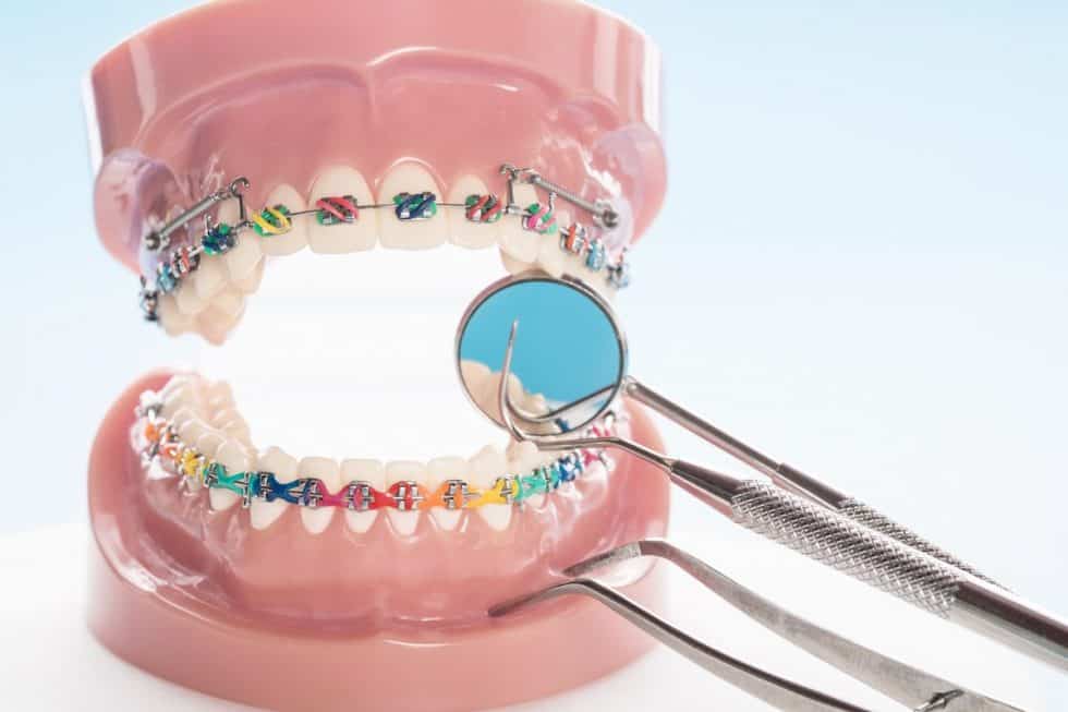 Dental Services in Leederville - Dentists on Vincent Leederville